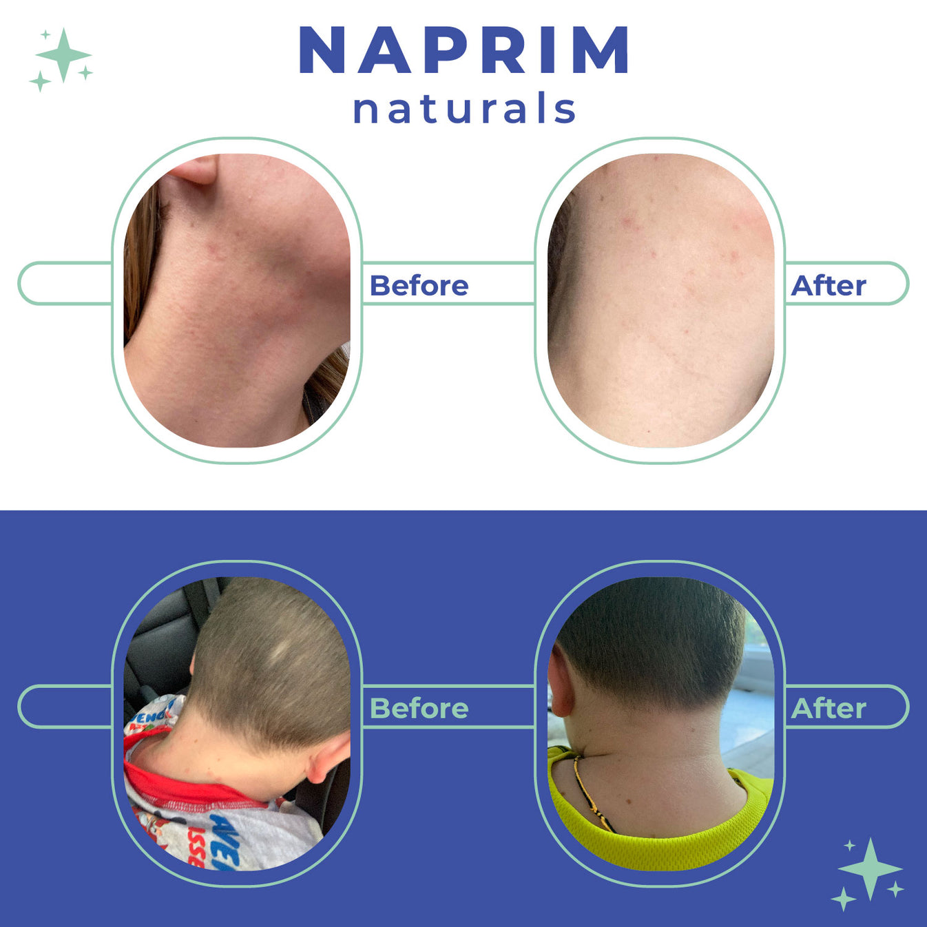 Dusting Powder – NAPRIM Naturals